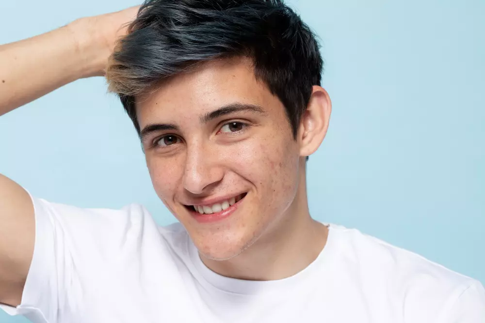 What’s the Best Treatment for Acne in Adults? | AK Beautiful You